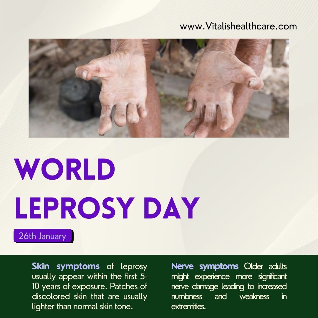 SYMPTOMS, CARE & SUPPORT TIPS FOR SENIORS WITH LEPROSY – Vitalis Home ...